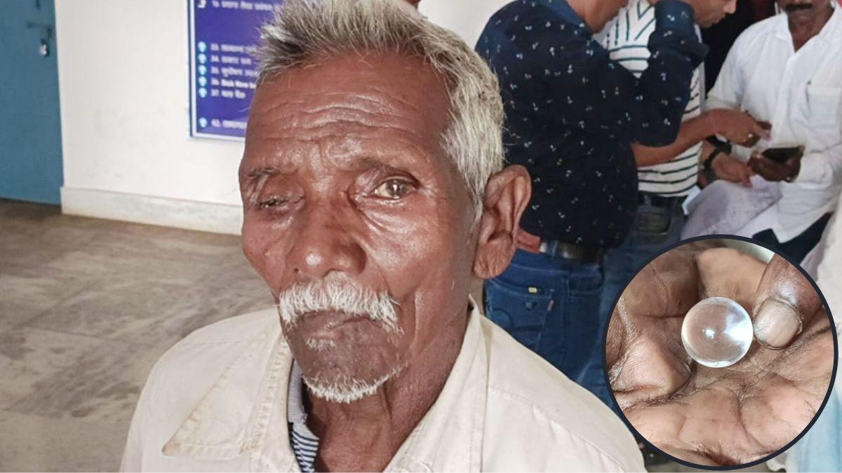 हाथ लगाते ही बाहर निकल आई आंख! हाथ में लेकर पहुंचे अस्पताल तो चौंक गए ...