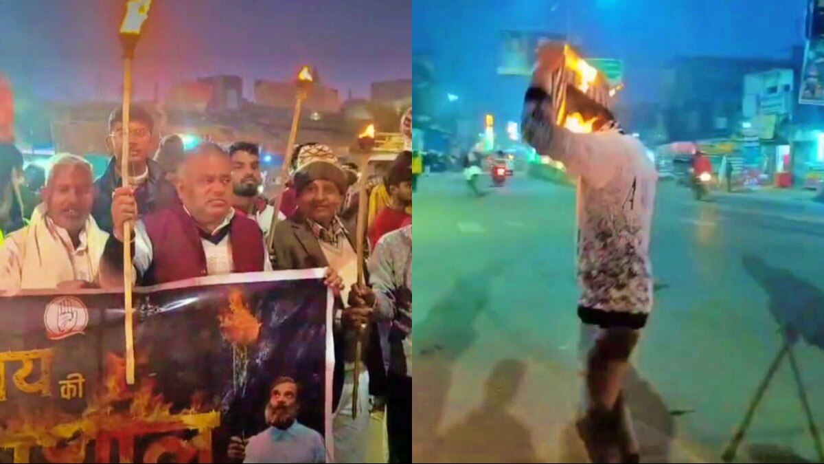 UP: कांग्रेस की मशाल यात्रा में दिखा रहा था करतब, मफलर में आग लगने से ...