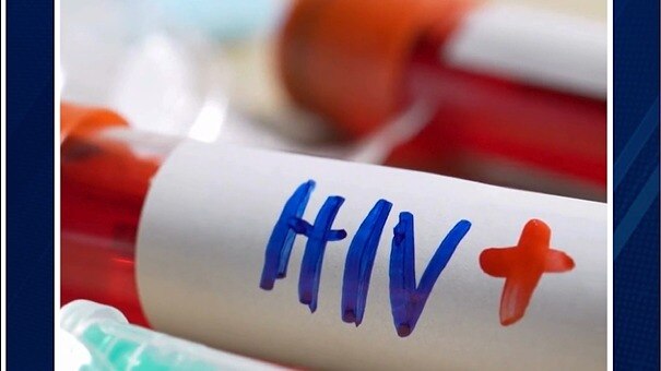 HIV किन-किन वजहों से होता है? जानें - short-videos AajTak