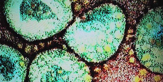 New killer virus from Middle East spreading, threat to the entire world ...