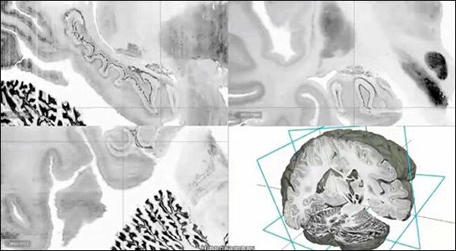Big Brain! Scientists make world's most detailed 3D brain map - India Today