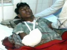 UP: Boy's hand chopped off - India Today