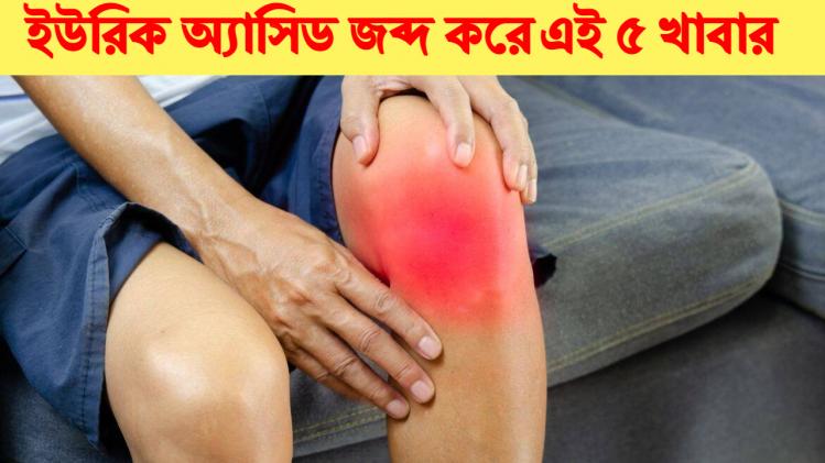 Uric Acid Control Tips: শীতে বেড়েছে গাঁটের ব্যথা, ৫ ঘরোয়া উপায়ে কমান ...