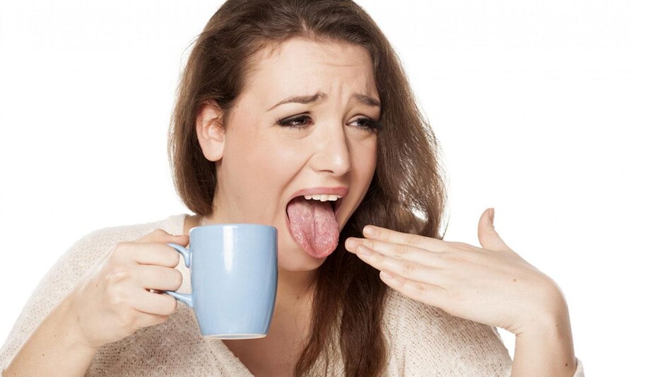 Remedies To Heal Burnt Tongue চা খেতে গিয়ে জিভ পুড়ল ৫ ঘরোয়া উপায়ে কমবে জ্বালা Tongue
