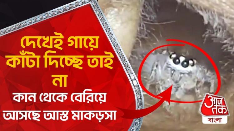 Tiny Spider Inside Woman's Ear: কান থেকে বেরিয়ে আসছে আস্ত মাকড়সা ...