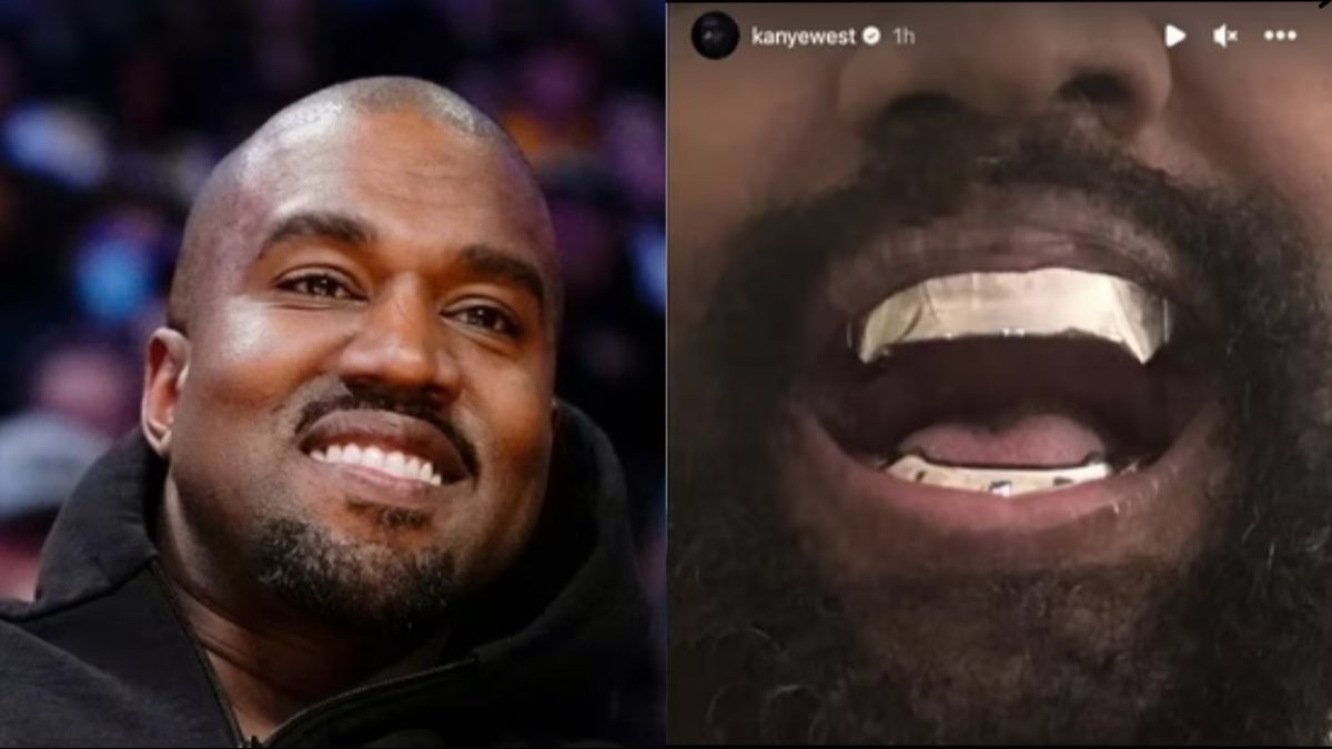 Kanye West Titanium teeth: रैपर कान्ये वेस्ट ने लगवाए टाइटेनियम के दांत ...