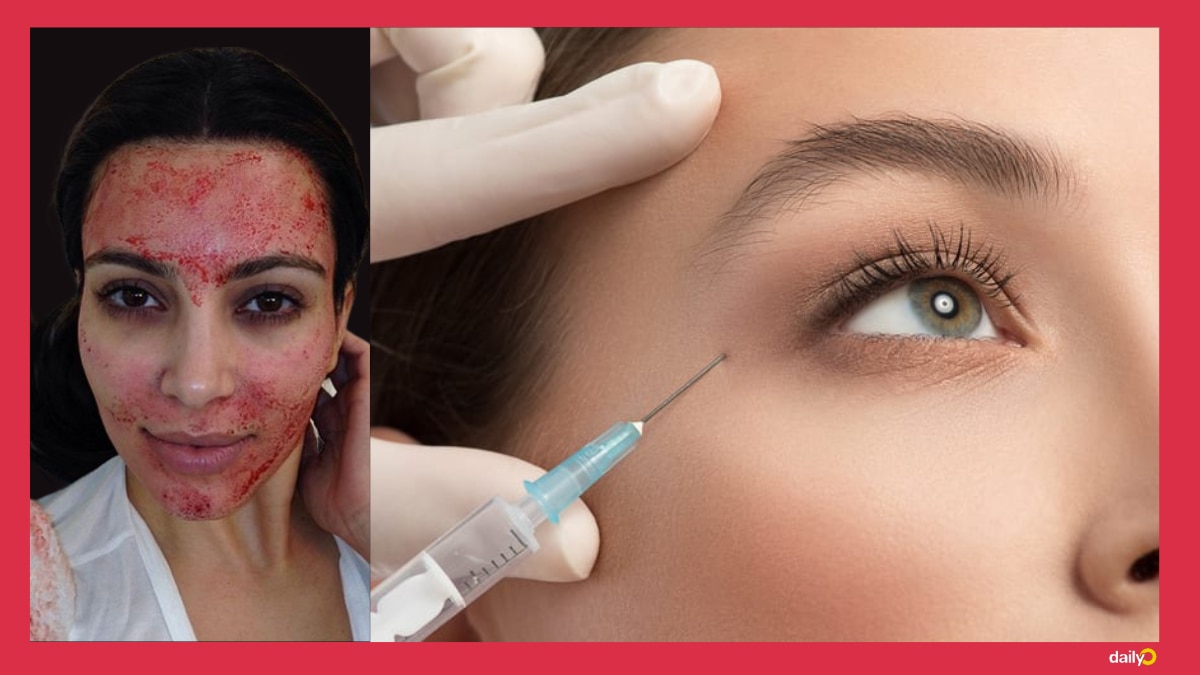 Can vampire facials or botox injections give you HIV?