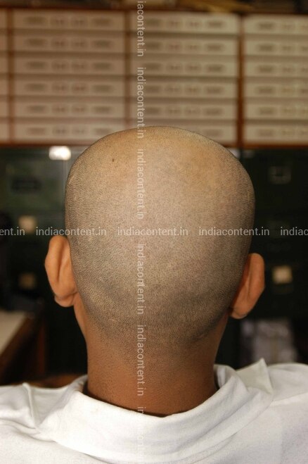 Buy Bald head Pictures, Images, Photos By Shome Basu - Archival pictures