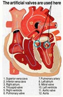 Breakthrough, at last - India Today