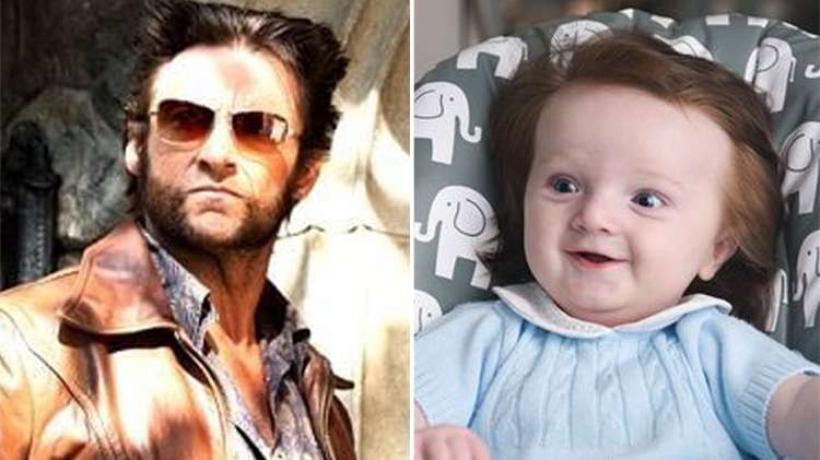 Meet 5-month-old 'Mini Wolverine,' whose superpower lies in his hair