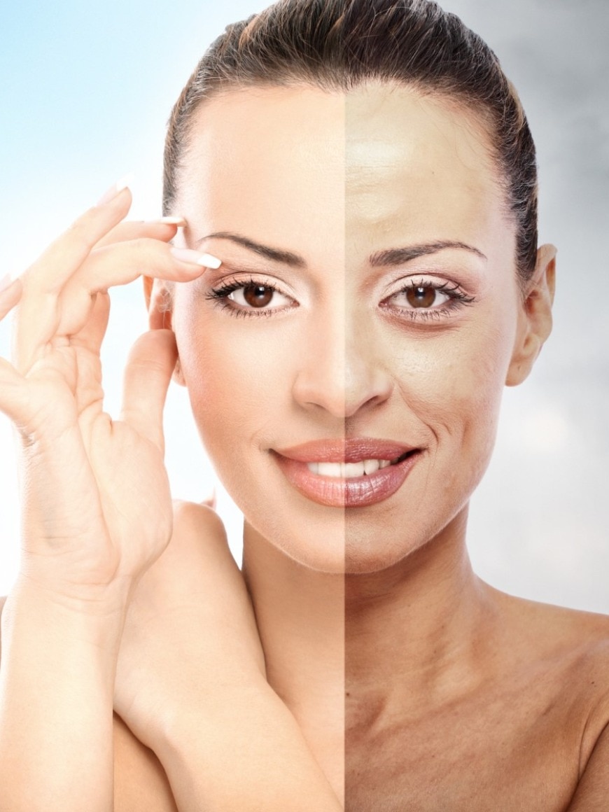 How to care Skin in Winter sus