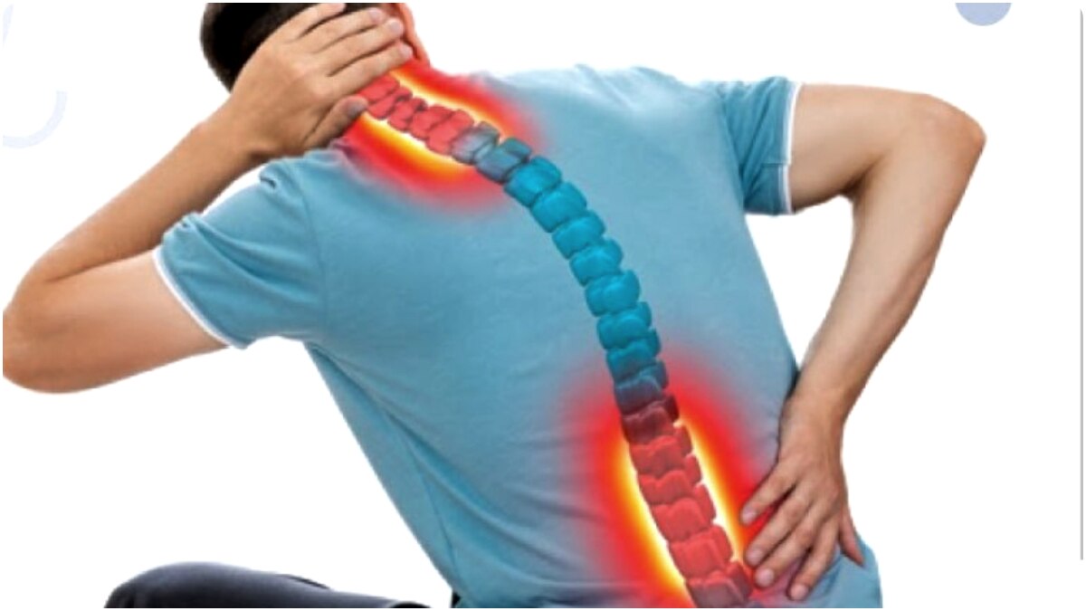 ঘাড়ে-পিঠে অসহ্য ব্যথা, স্পন্ডিলাইটিস নয় তো?
