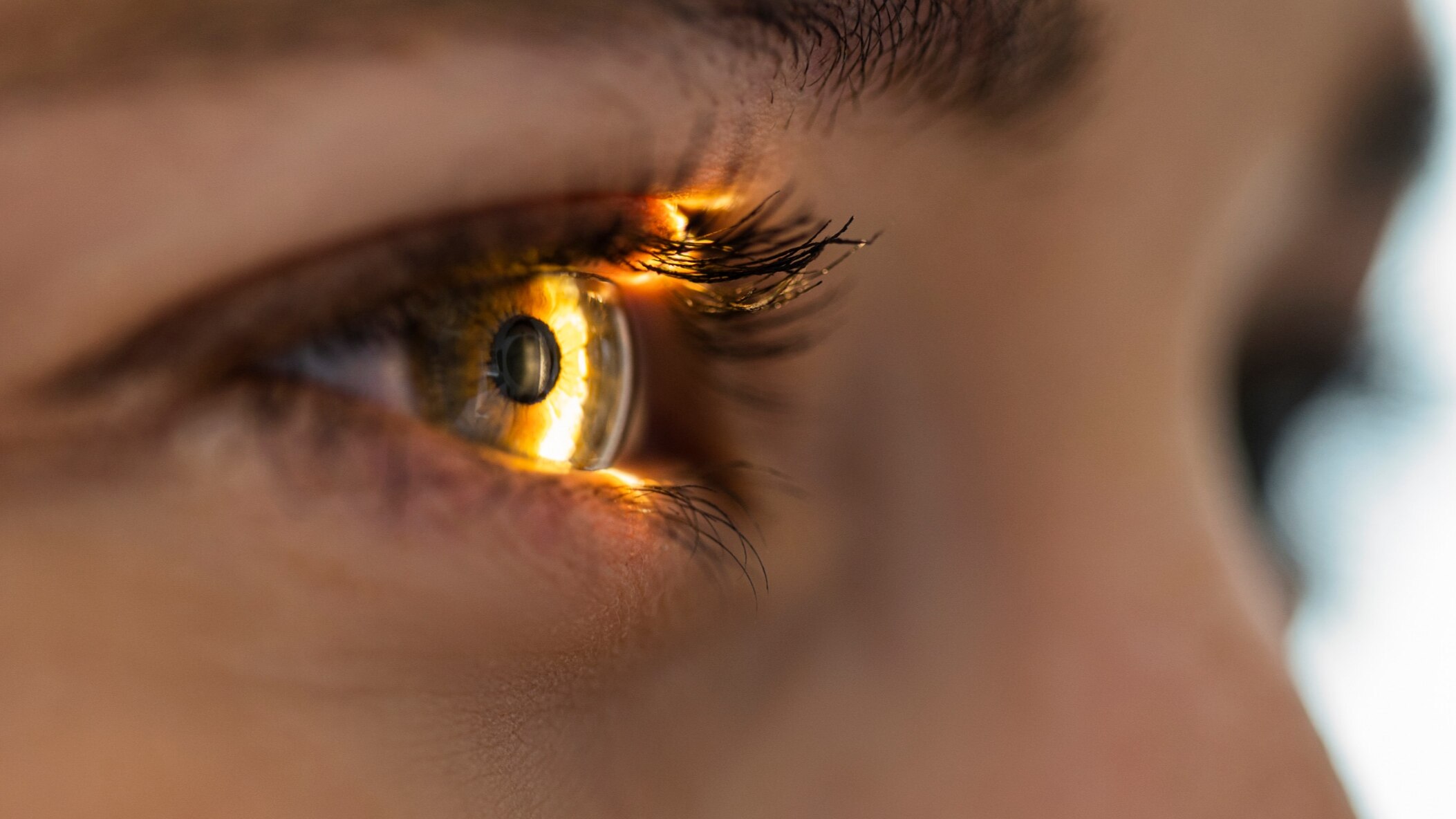 What is eye stroke, caused by heatwave?